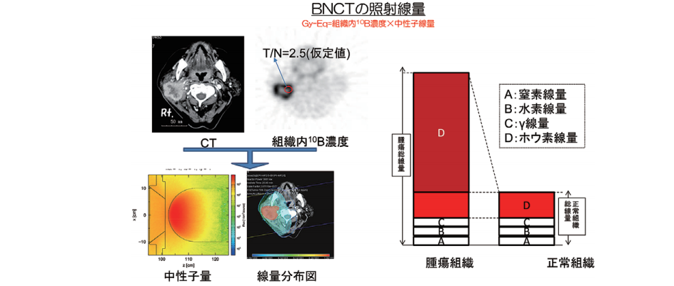 日本BNCT最新临床治疗数据出炉